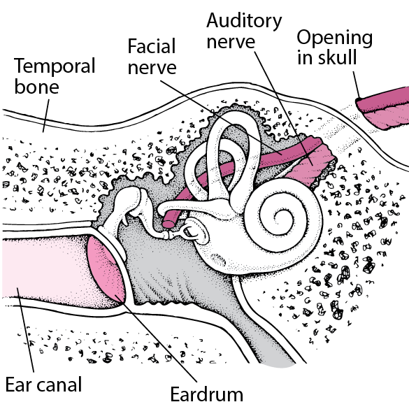 temporal bone ear