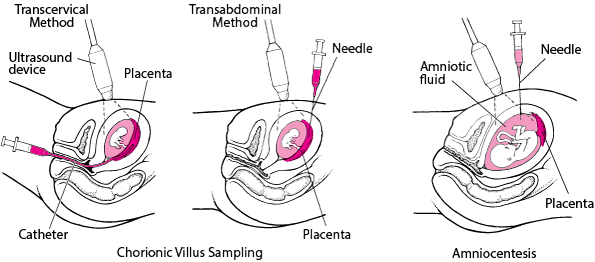 chorionic villus sampling test